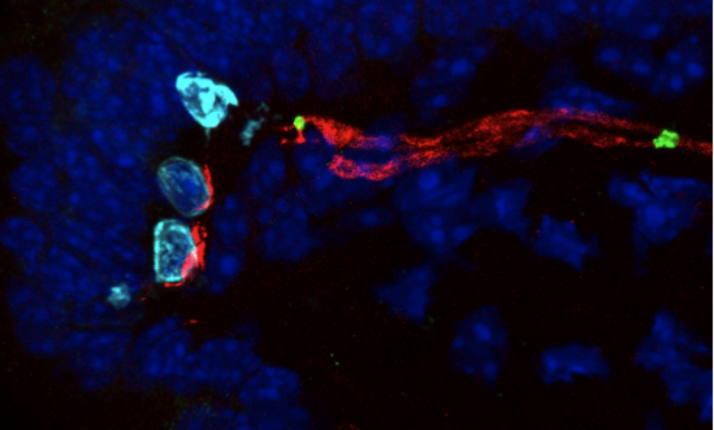 The Science Behind a Soft Caress | Columbia University Irving Medical ...