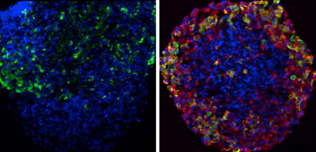 CRISPR, Stem Cells, and Neonatal Diabetes | Columbia University Irving ...