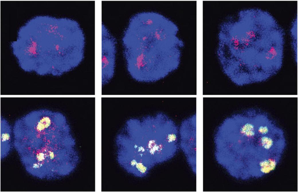 Will Revitalizing Old Blood Slow Aging? | Columbia University Irving ...