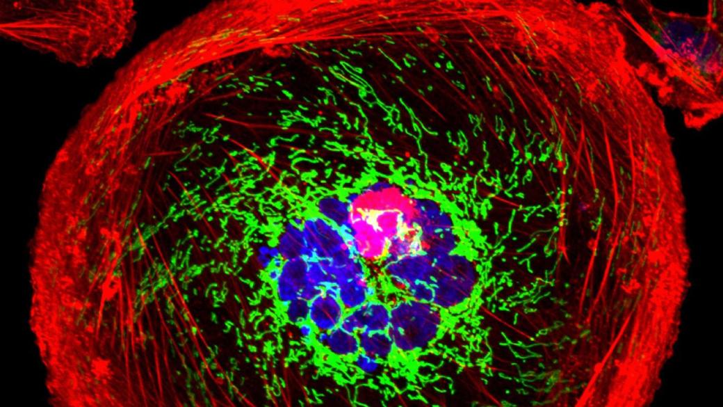 News | Columbia University Irving Medical Center