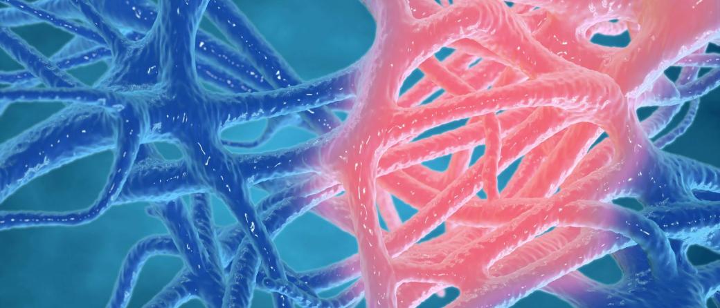 “Silent Fire”: The Dangers of Hidden Inflammation | Columbia University ...