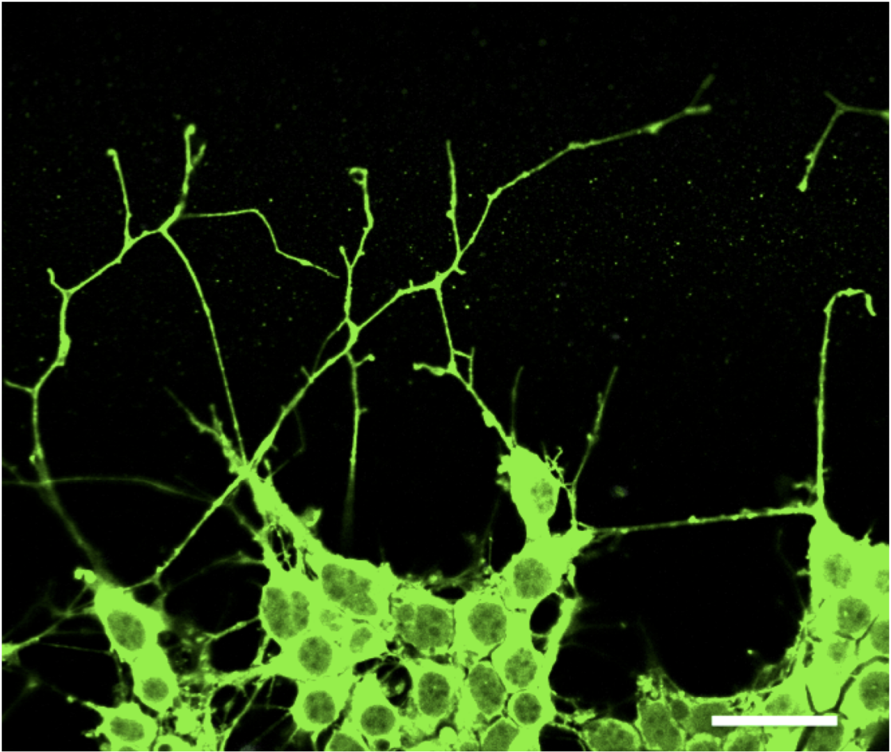Recording Cancer Cells from the Inside | Columbia University Irving ...