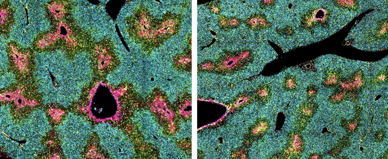 Secret Boss of The Liver: Star-Shaped Cells That Promote Fibrosis Also ...