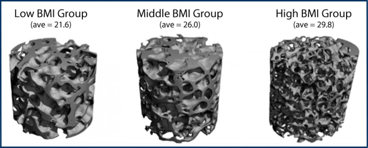 Study Finds Belly Fat is Associated with Poor Bone Quality | Columbia ...