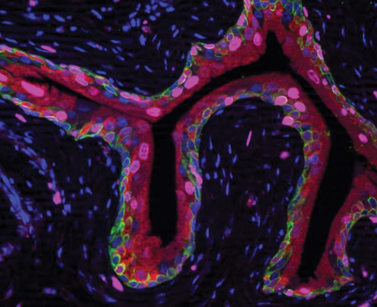 Researchers Discover Cells that Restore Bladder’s Unique Lining ...