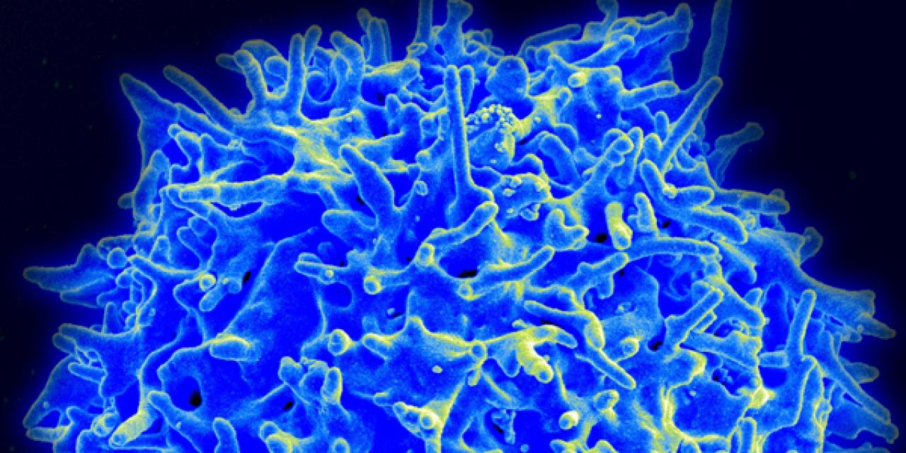 T Cells Work Like Local Militias, Not National Army | Columbia ...