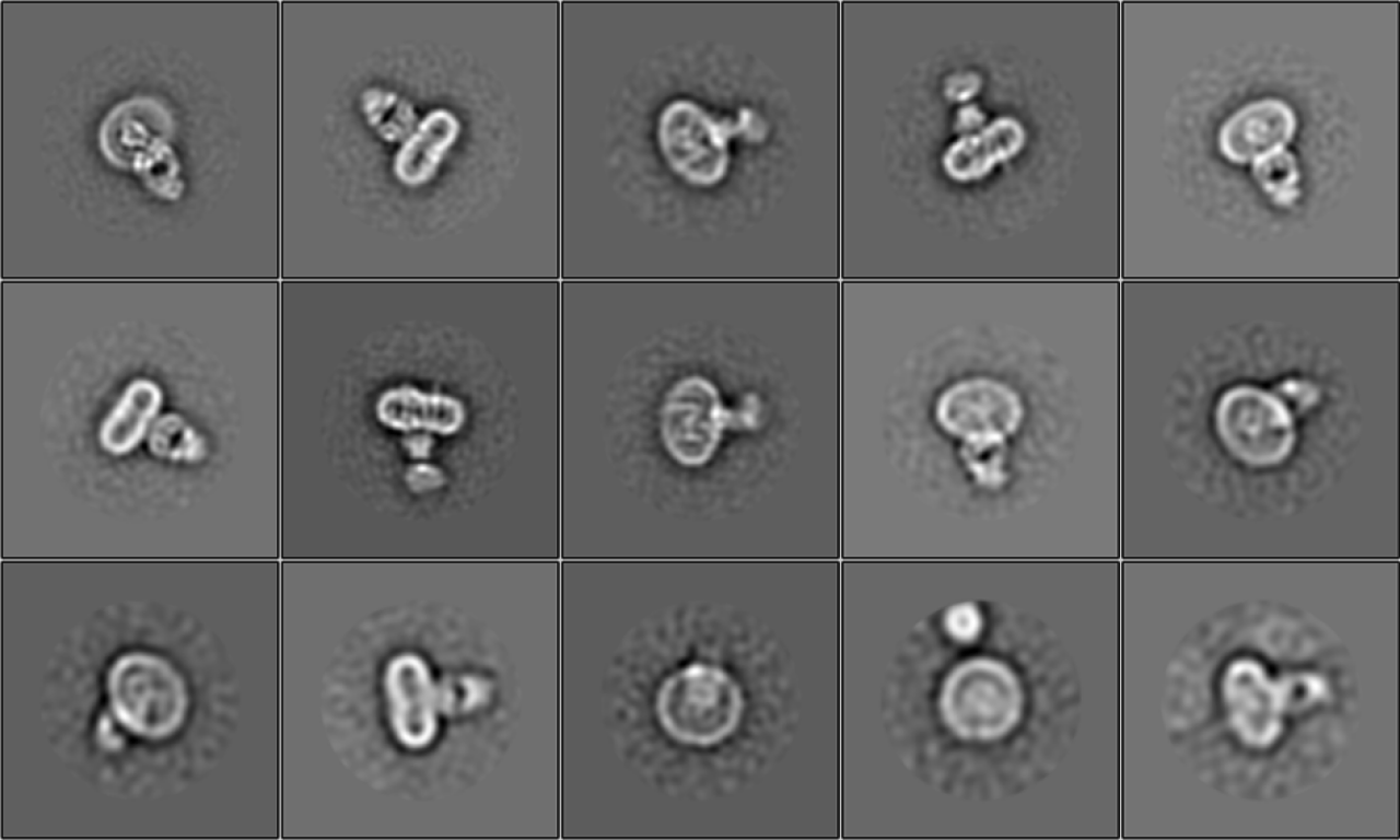 New Images Show How Malaria Parasites Evade Frontline Drugs | Columbia ...