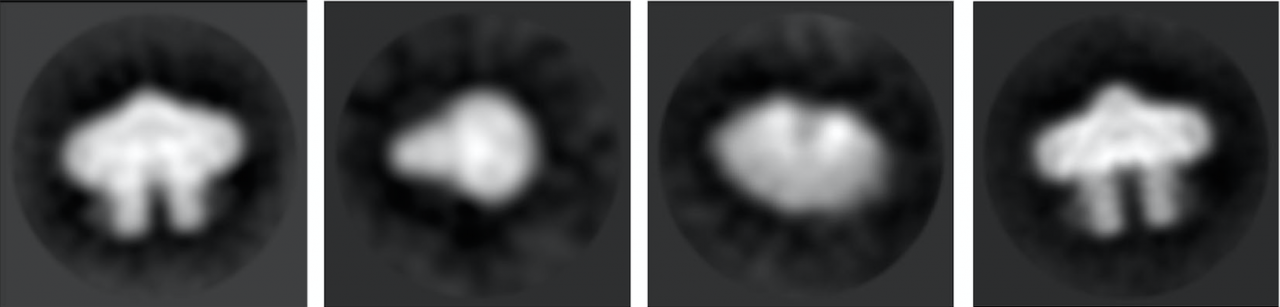 Electron Microscopy Reveals How Vitamin A Enters the Cell | Columbia ...