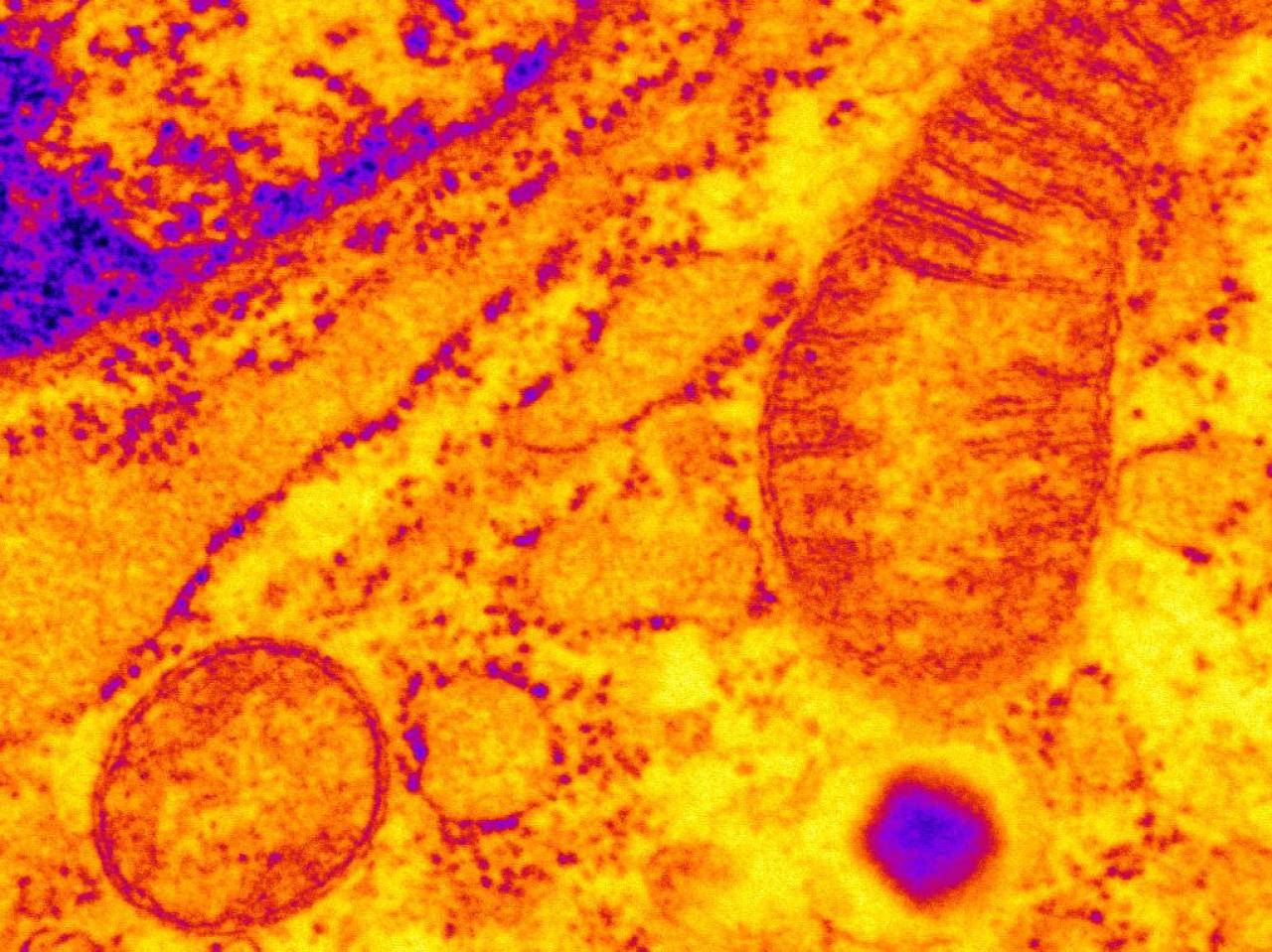 Cellular Defect Linked to Diabetes | Columbia University Irving Medical ...