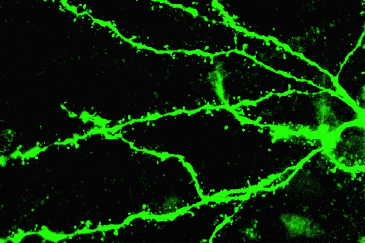 Dopamine Helps Neurons Grow Up | Columbia University Irving Medical Center