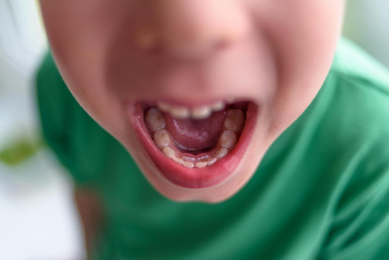 Yes, you do brush baby teeth | Columbia University Irving Medical Center