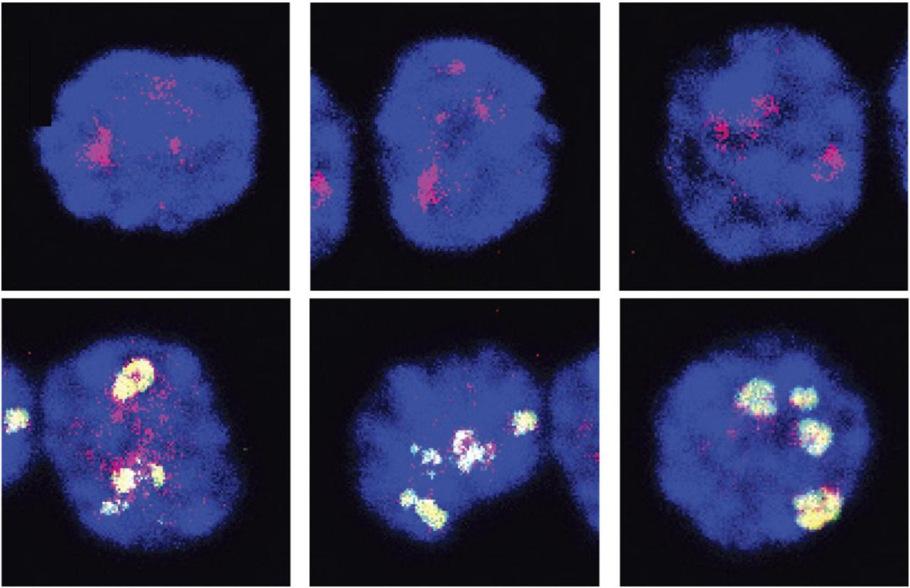 Will Revitalizing Old Blood Slow Aging? | Columbia University Irving ...