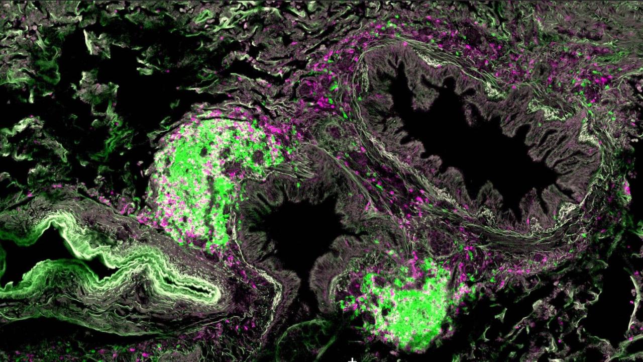 New Research Shows Babies’ Immunological Weak Spot and Strength ...