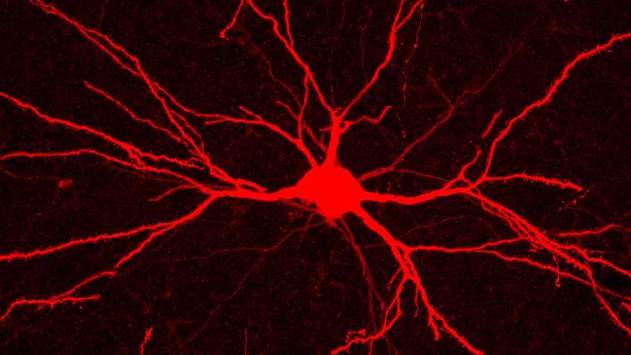 Study Appears to Overturn Prevailing View of How the Brain is Wired ...