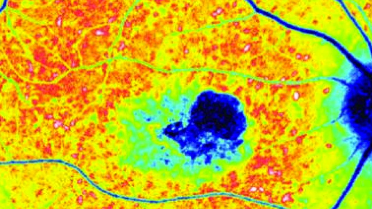 Using the Retina’s Natural Fluorescent Light to Measure and Treat ...
