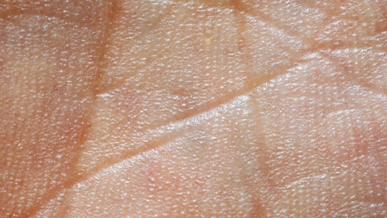 More Than Skin Deep: Interdisciplinary Dermatology Research | Columbia ...