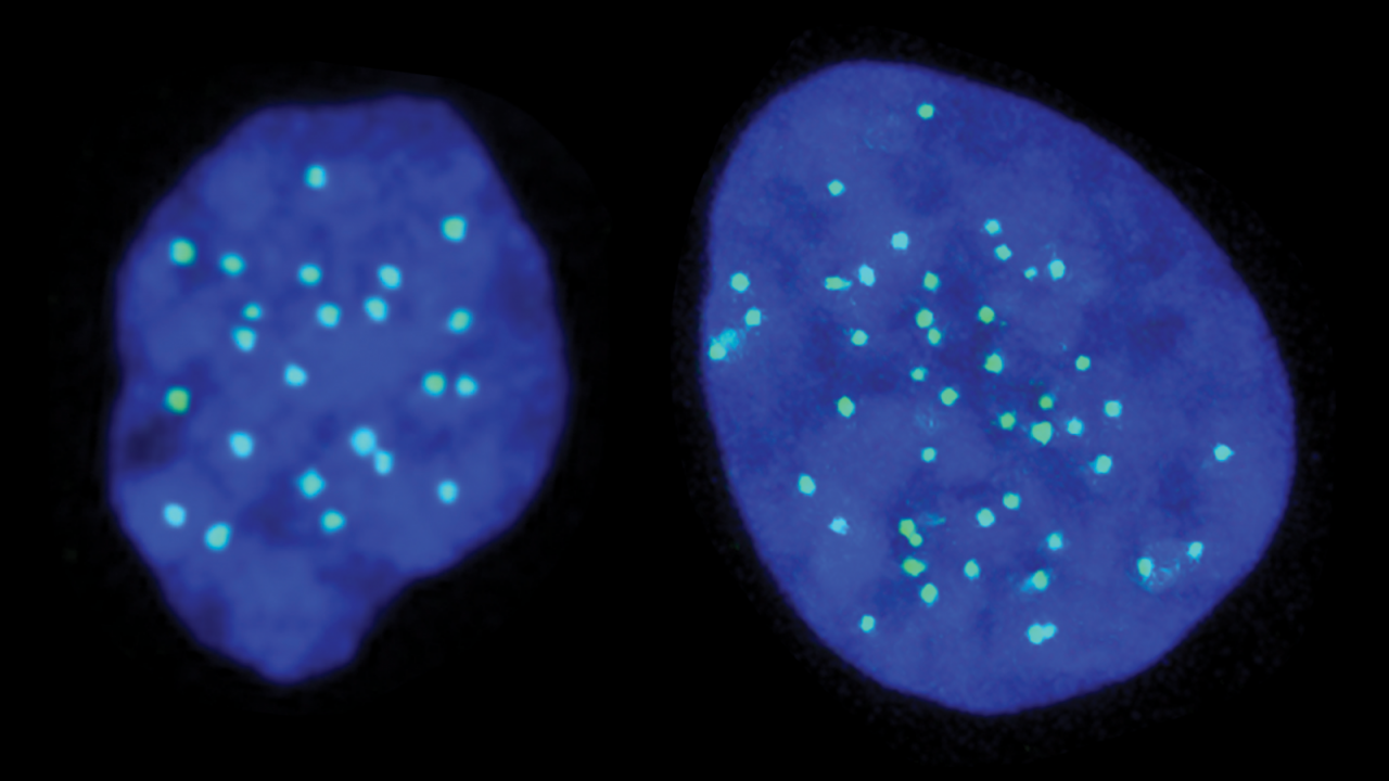 Scientists Generate a New Type of Human Stem Cell That Has Half a ...