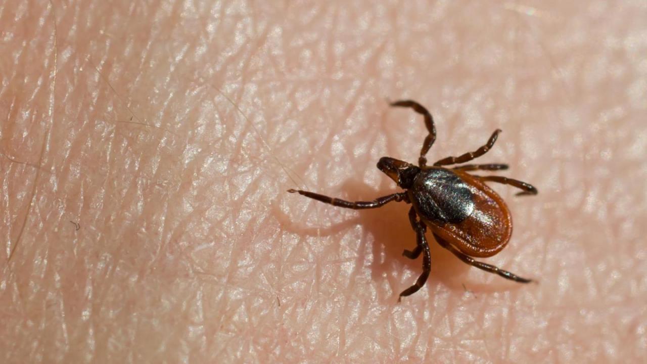 VIDEO: How to Prevent Getting Bitten by a Tick | Columbia University ...