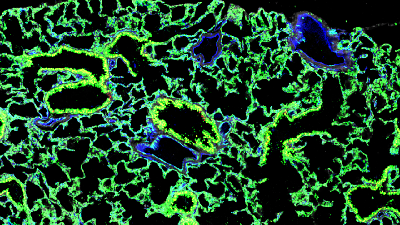 Stem Cell Transplants Used to Grow Fully Functional Lungs in Mice ...