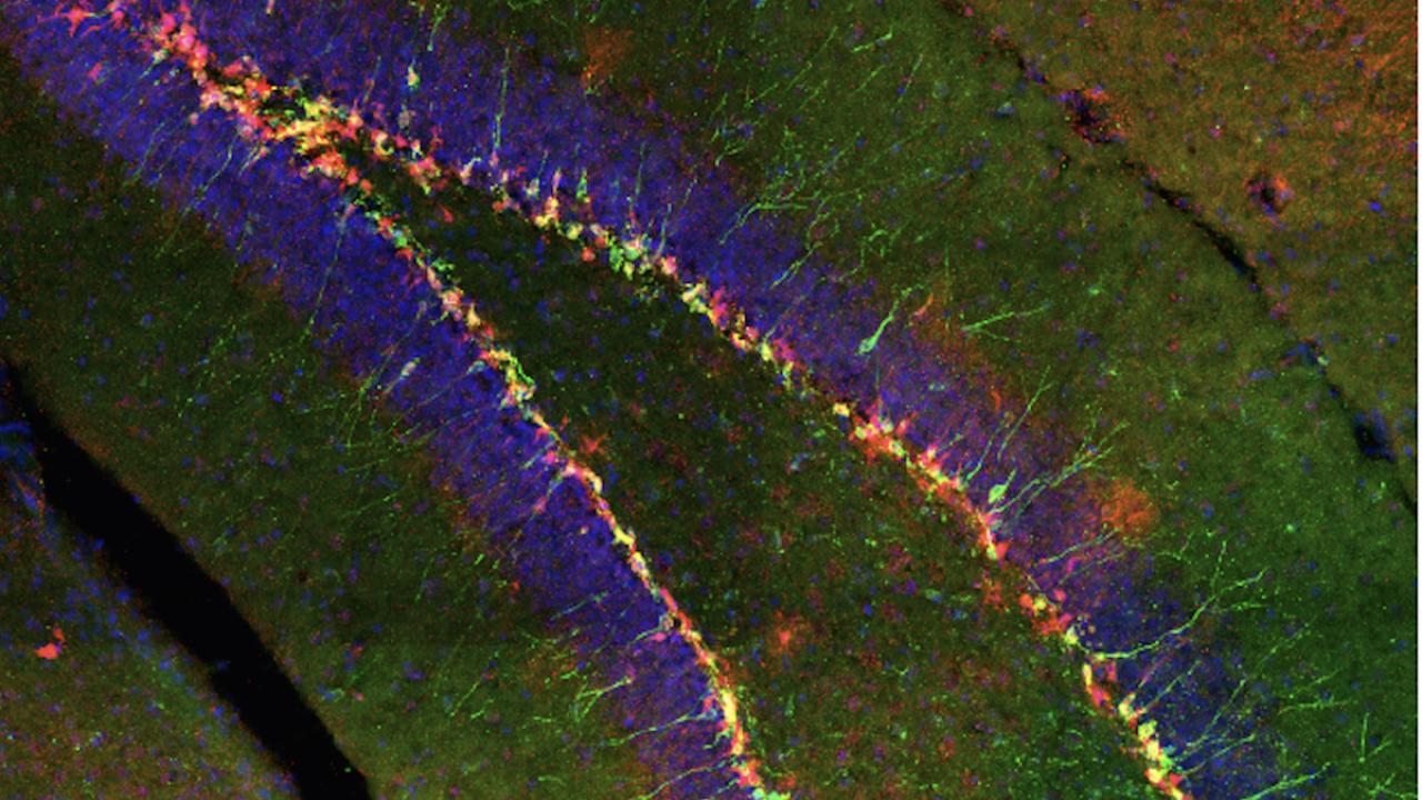 New Brain Cells Increase Resilience to Stress | Columbia University ...