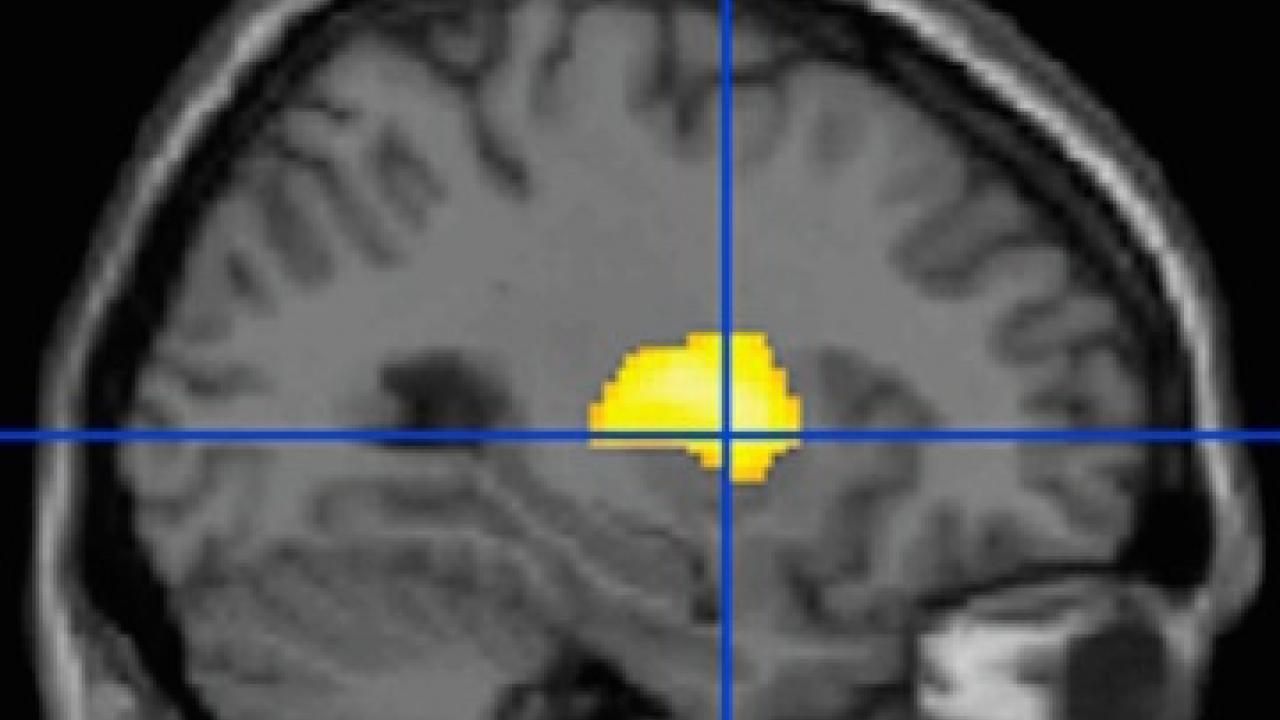 Weed Effects On Brain