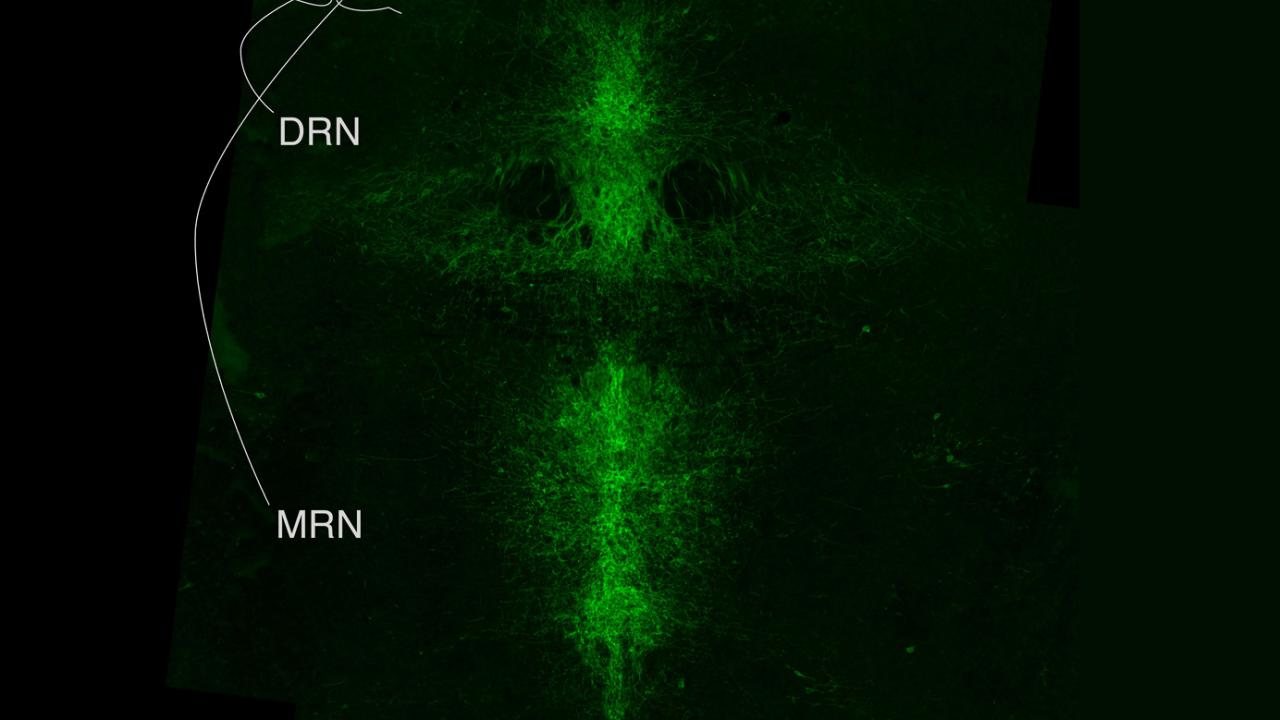 Yin and Yang of Serotonin Neurons in Mood Regulation | Columbia ... Yin and Yang of Serotonin Neurons in Mood Regulation | Columbia ...