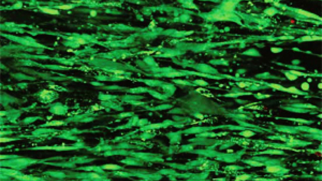 Tissue Regeneration for Orthopedic Repair | Columbia University Irving ...