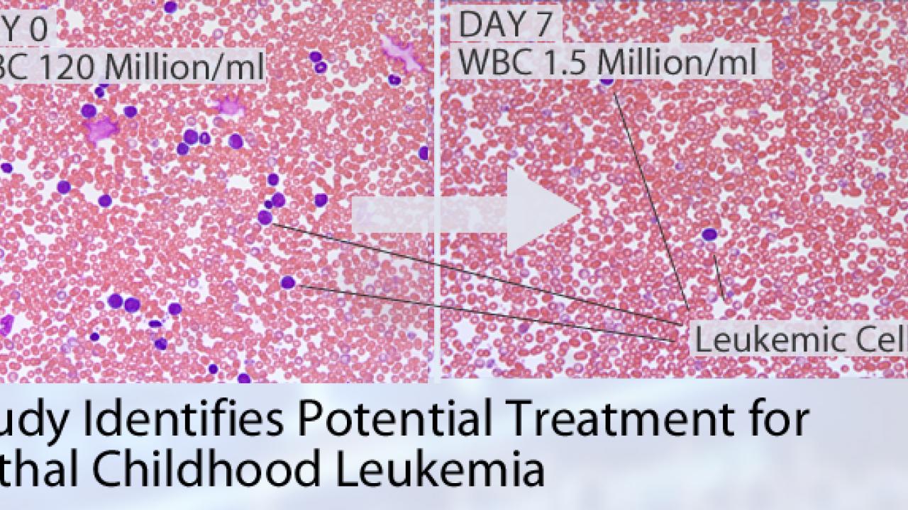 Study Identifies Potential Treatment for Lethal Childhood Leukemia ...