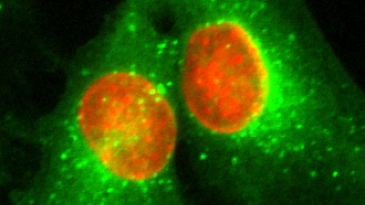 Potential Drug Treatment for a Lethal Heart Disorder | Columbia ...