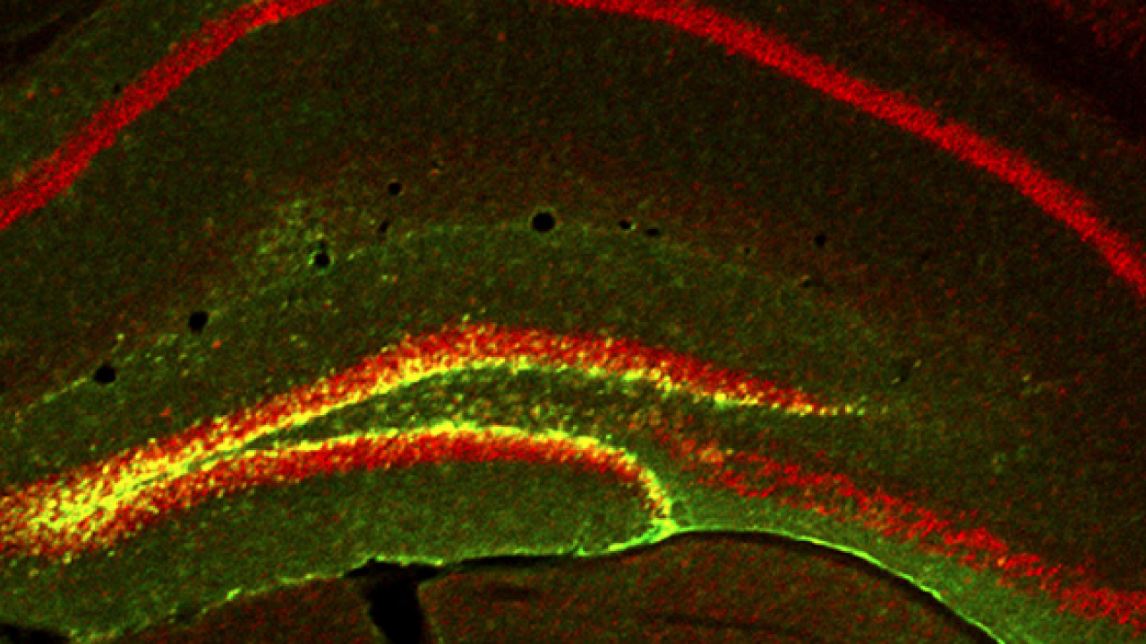 A Major Cause of Age-Related Memory Loss Identified | Columbia ...