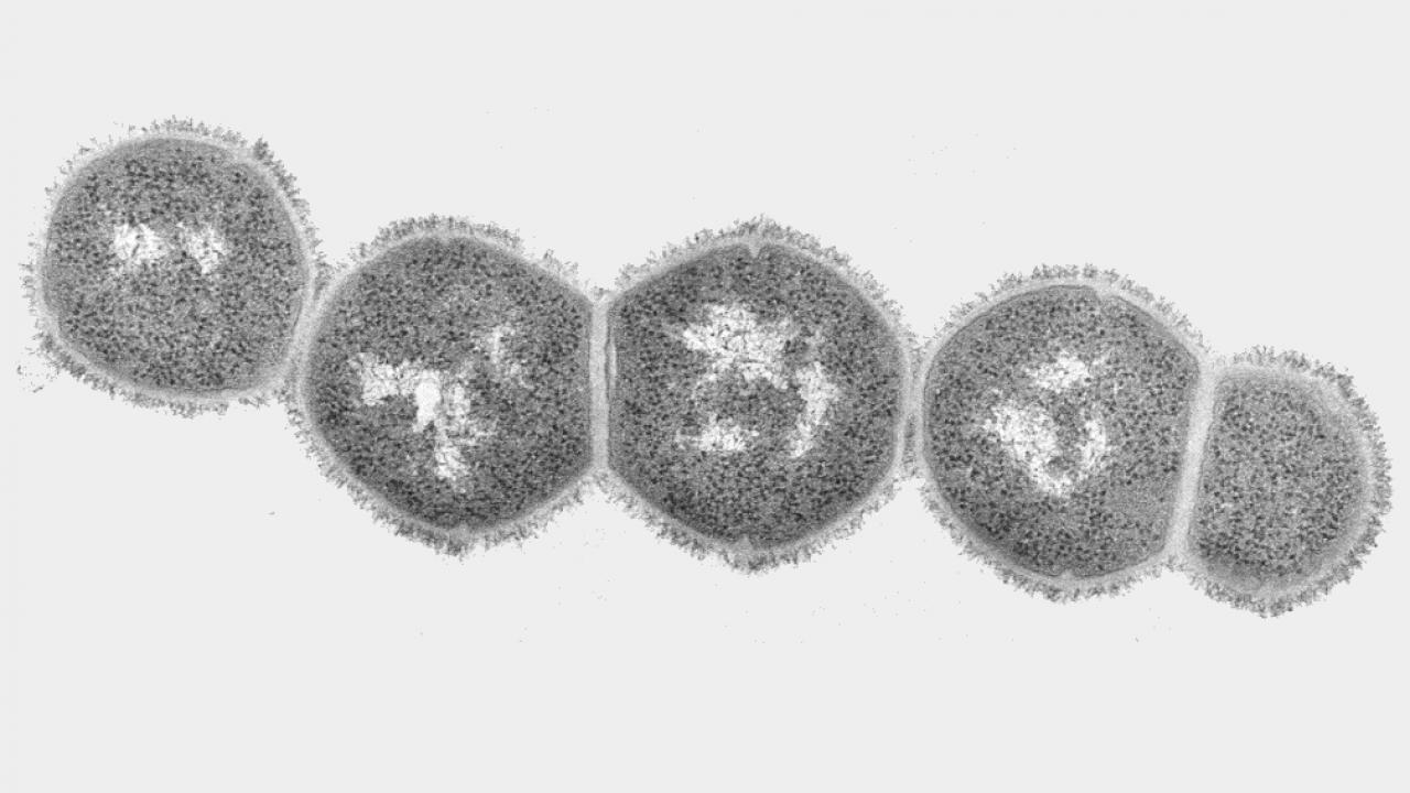 How Recurrent Strep A Infections Affect the Brain | Columbia University ...