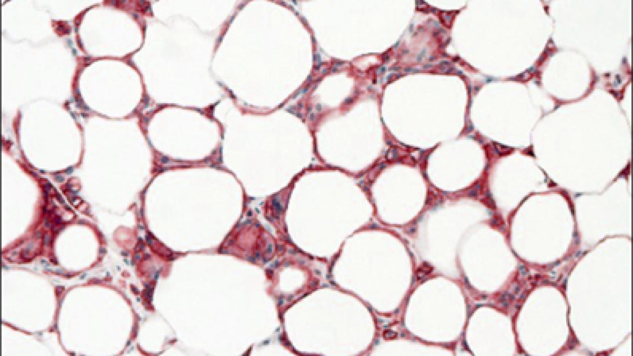 Belly Fat Promotes Diabetes Under Orders from Liver | Columbia ...