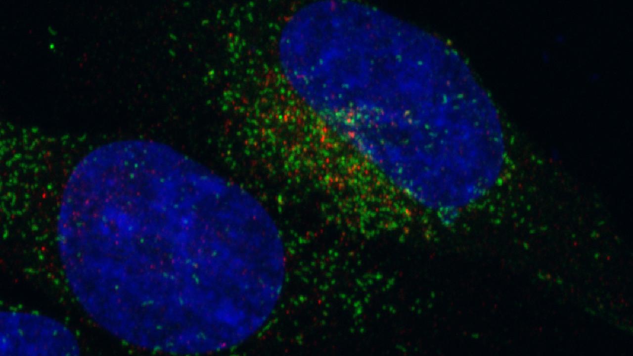 Gene Fusion Shifts Cell Activity into High Gear, Causing Some Cancer ...