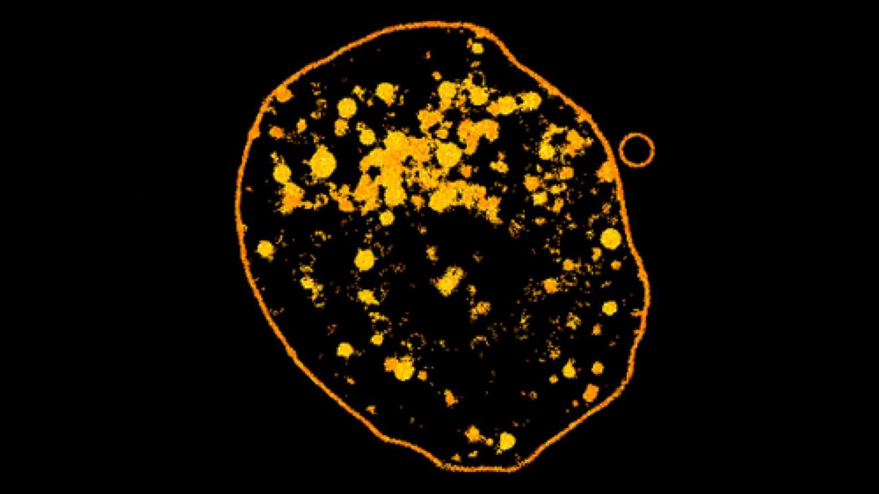 Fat ‘Shield’ Protects Immune Cells—and Some Cancers—from Destruction ...