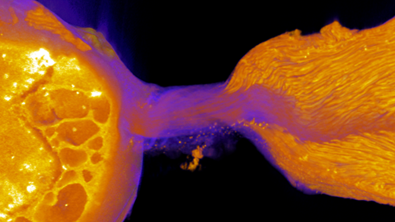 Can Stem Cells Improve Shoulder Surgery? | Columbia University Irving ...