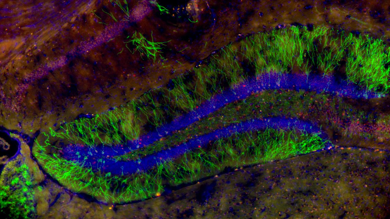 Baby Neurons in Adult Brains Are Needed to Maintain Memory | Columbia ...