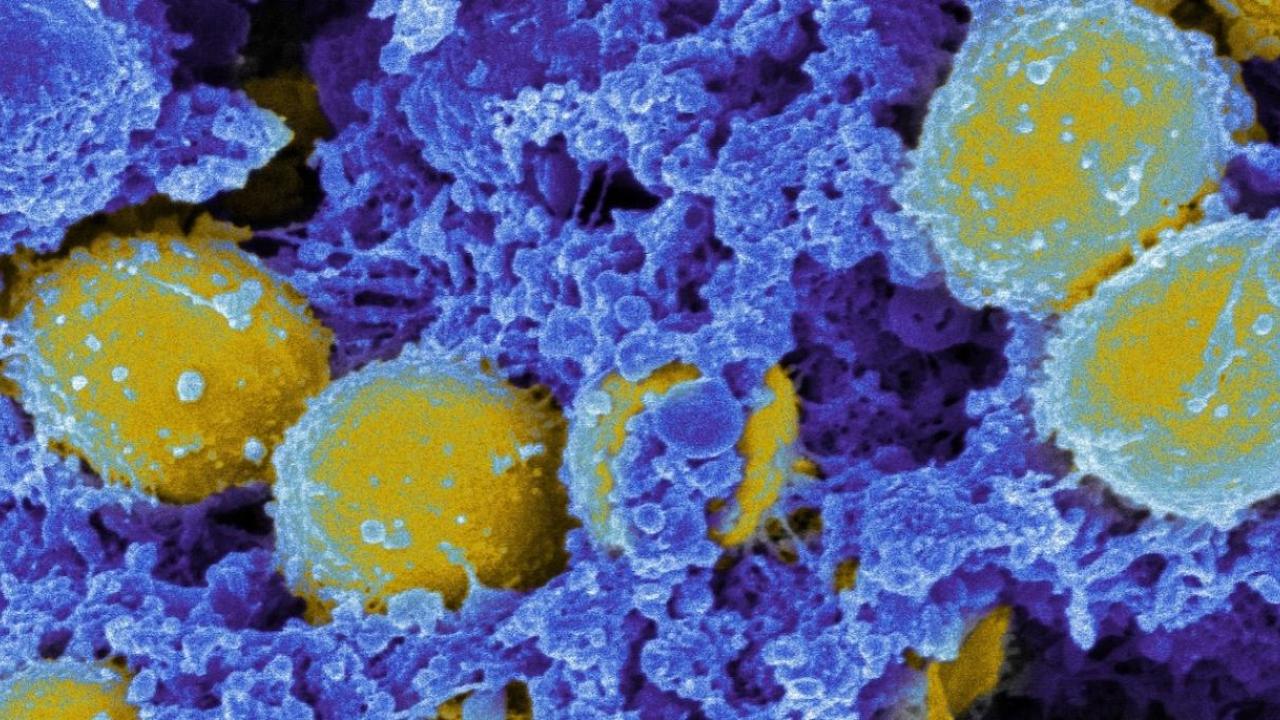 Staph’s Achilles' Heel May Be Its “Stomach” | Columbia University ...