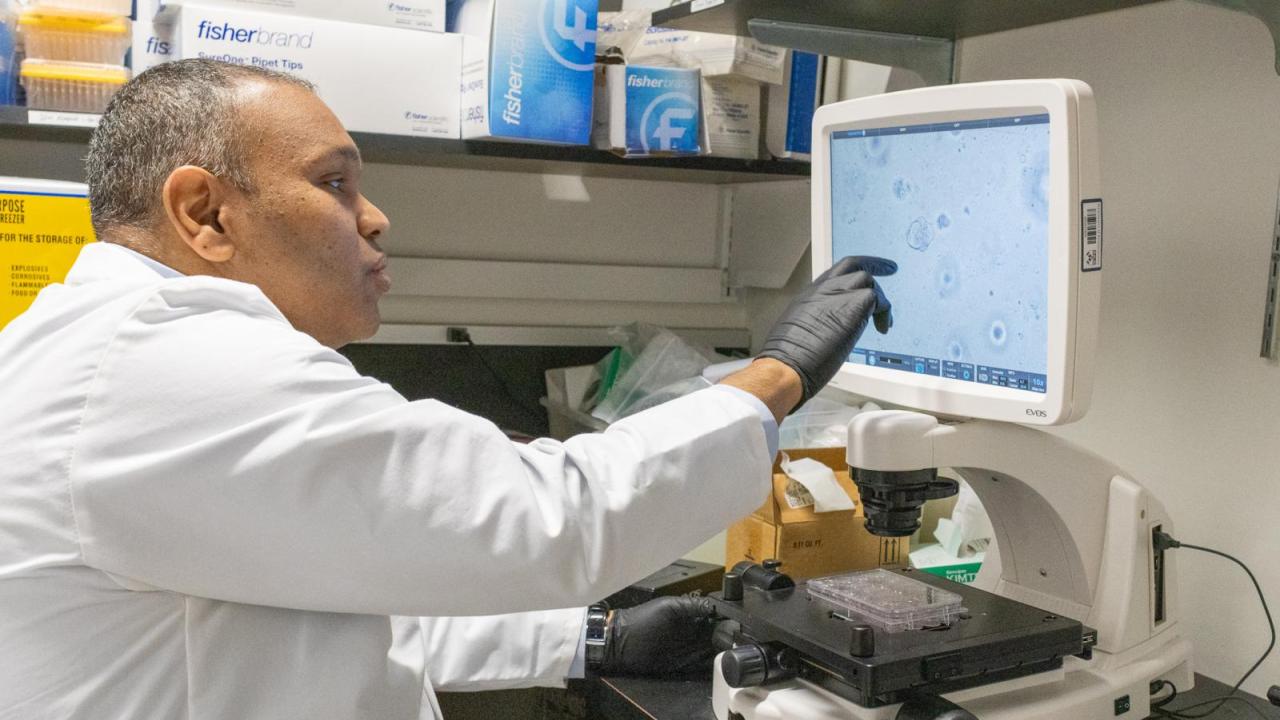 Columbia Researchers Seek Answers for Rise of Colon Cancer in Younger ...