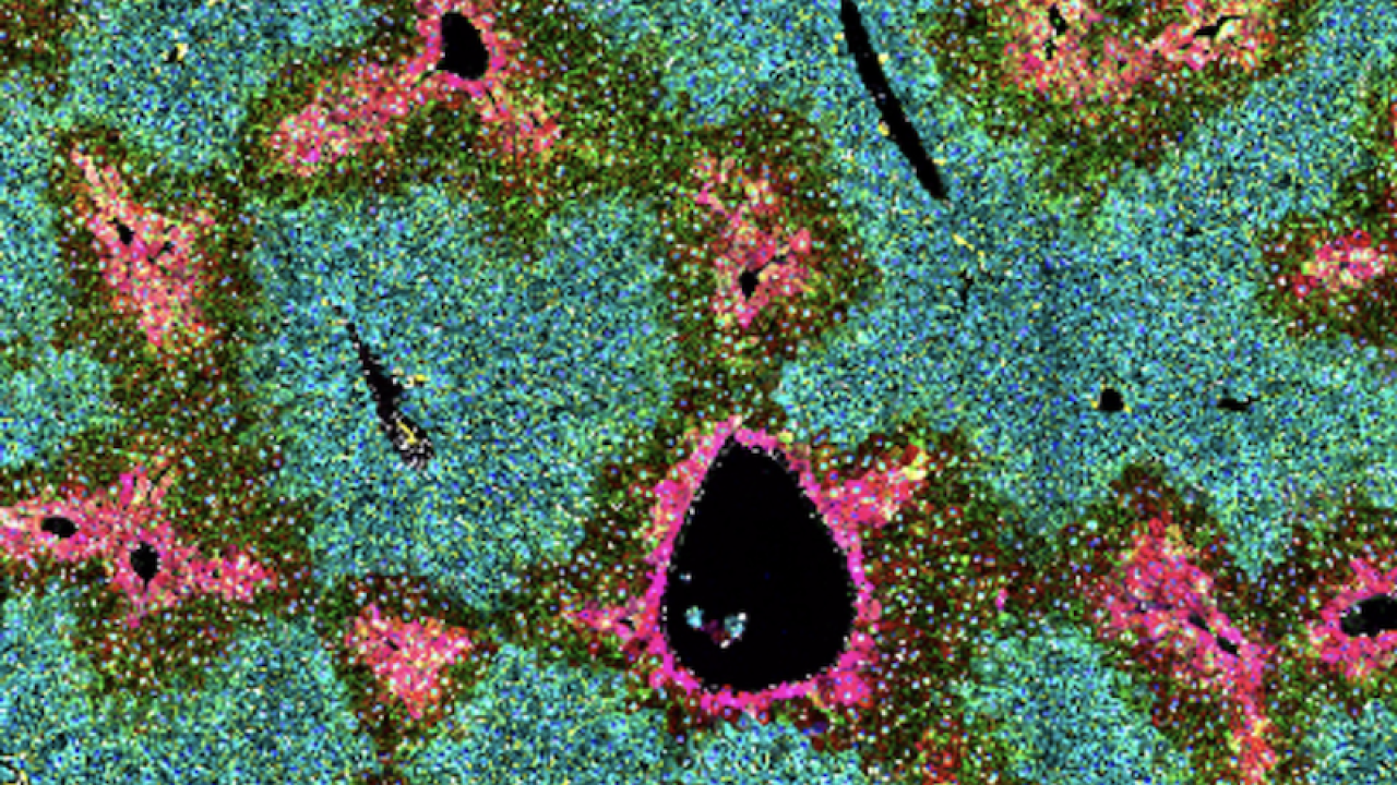 Secret Boss of The Liver: Star-Shaped Cells That Promote Fibrosis Also ...