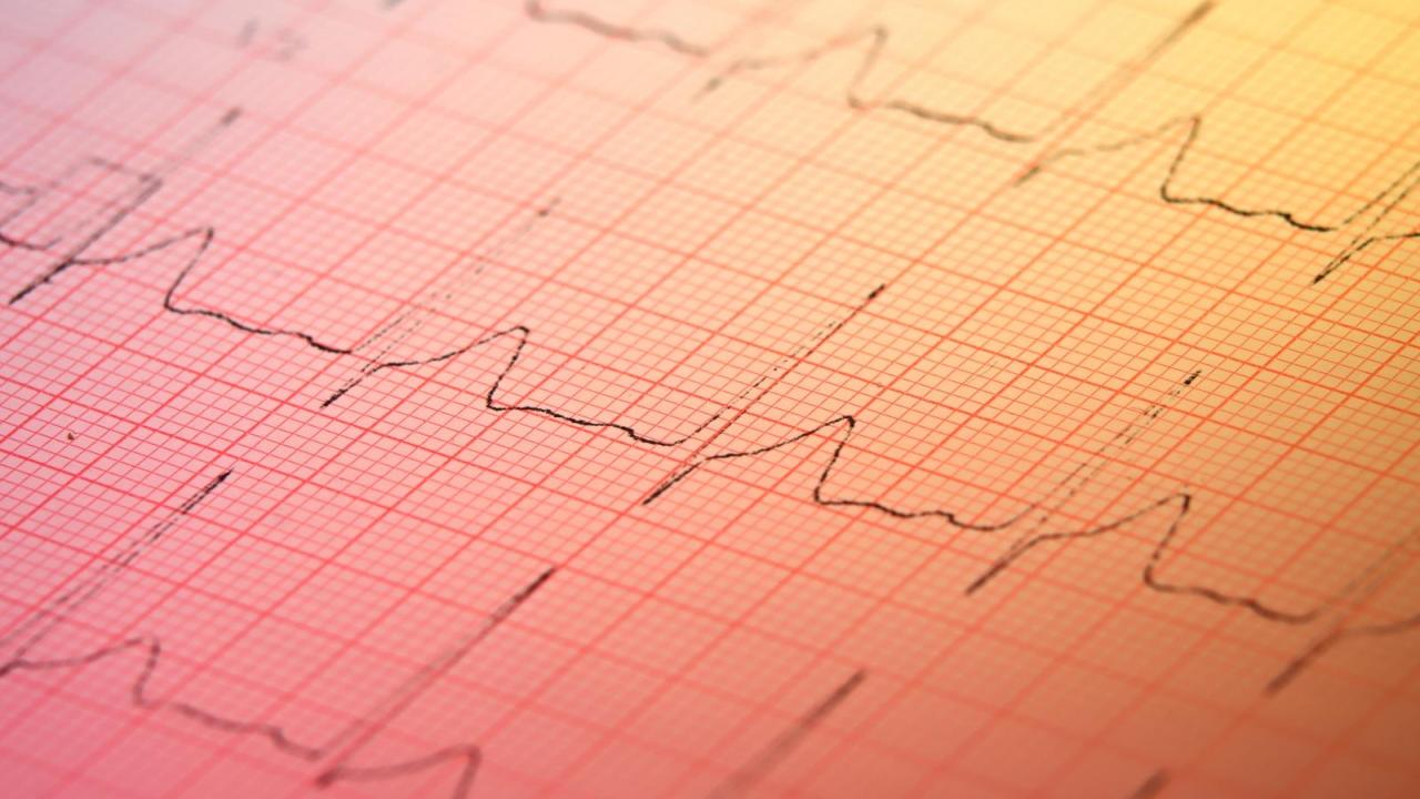 Can AI Detect Hidden Heart Disease? | Columbia University Irving ...
