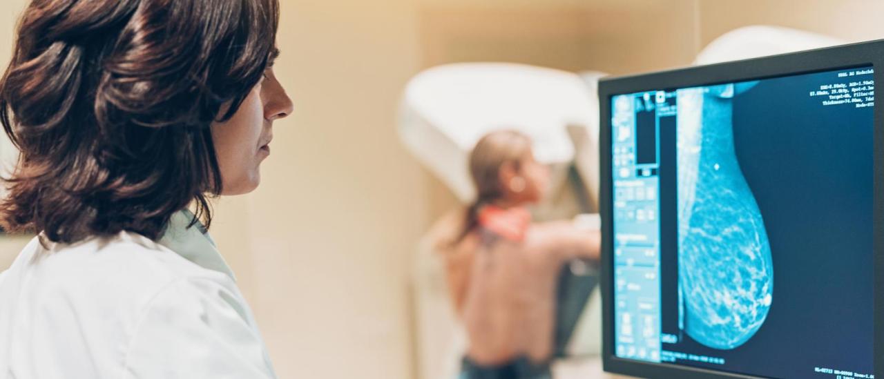 dense-breasts-explained-columbia-university-irving-medical-center