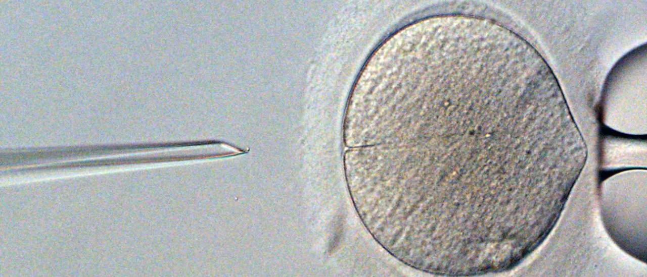Study Finds Why Many IVF Embryos Fail to Develop | Columbia University ...