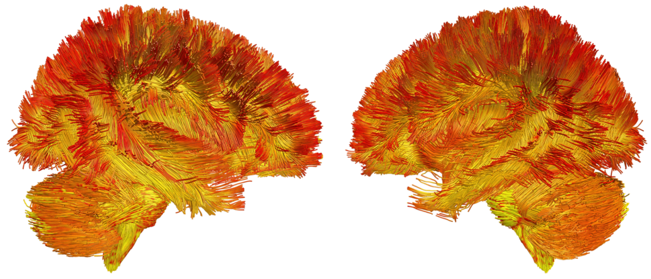 Atlas of Brain’s Mitochondria Reveals High Cognition Areas Supplied ...