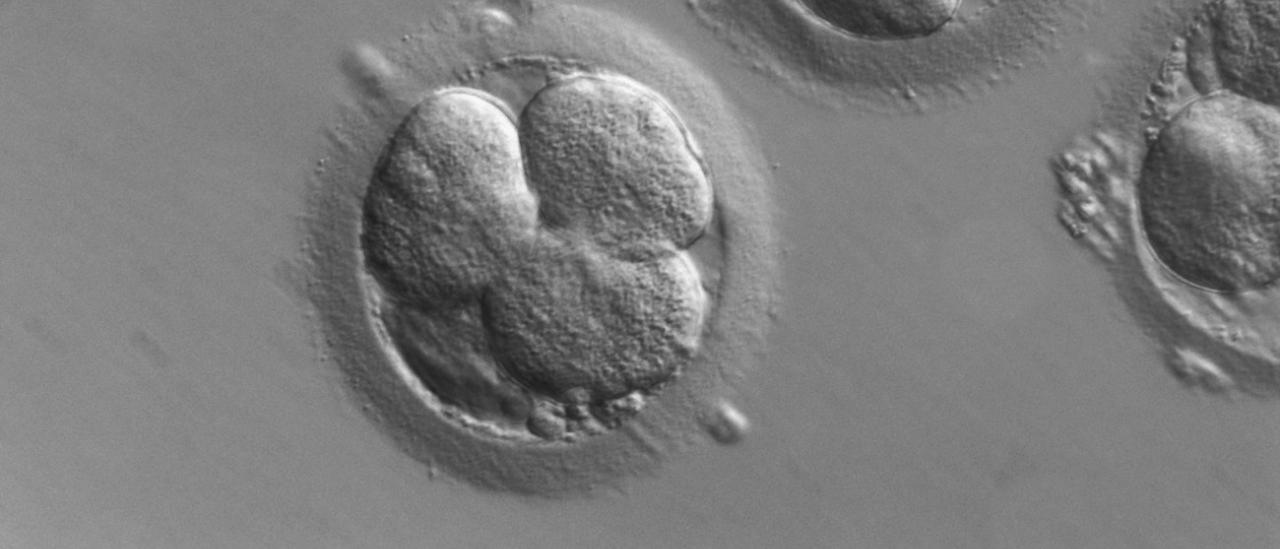 Development is Stressful. Why Can’t Human Embryos Cope Better ...