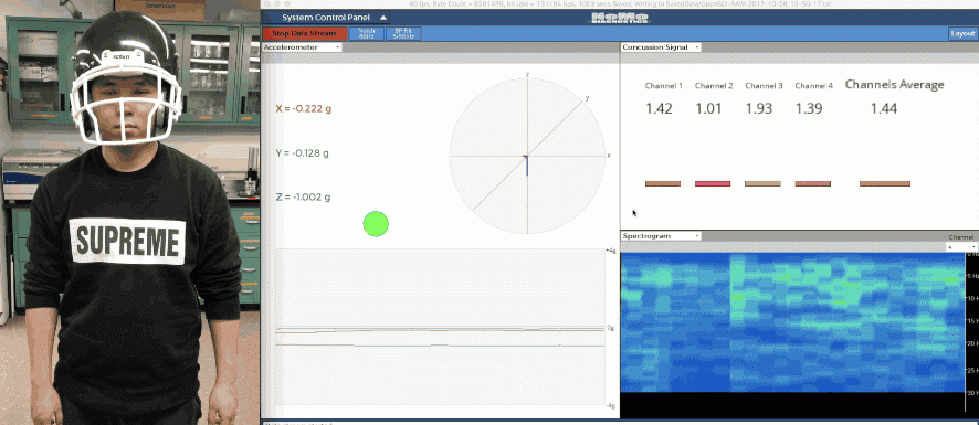 Outfitting a Football Helmet to Diagnose Concussion | Columbia ...