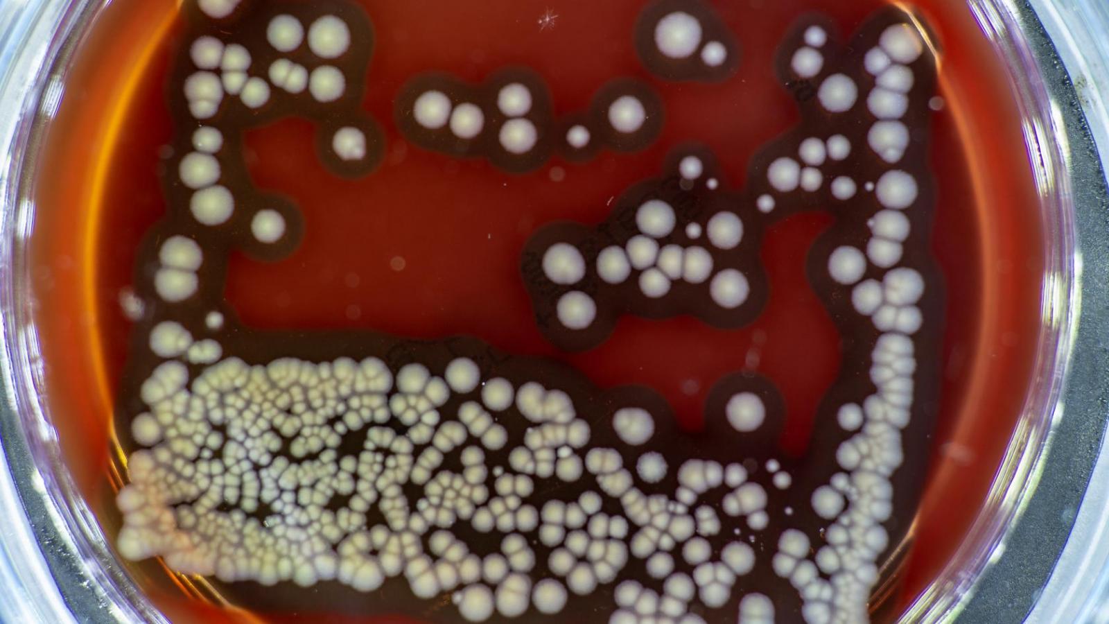 In Cystic Fibrosis, Lungs Feed Deadly Bacteria | Columbia University ...