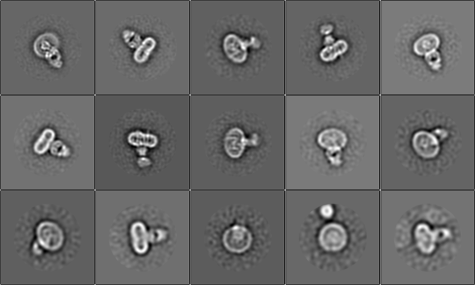 New Images Show How Malaria Parasites Evade Frontline Drugs | Columbia ...