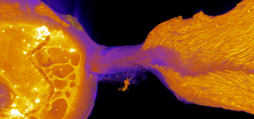 Can Stem Cells Improve Shoulder Surgery? | Columbia University Irving ...