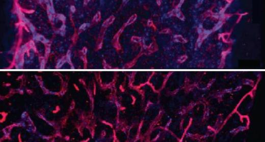 Will Revitalizing Old Blood Slow Aging? | Columbia University Irving ...