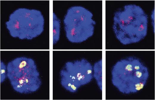Will Revitalizing Old Blood Slow Aging? | Columbia University Irving ...